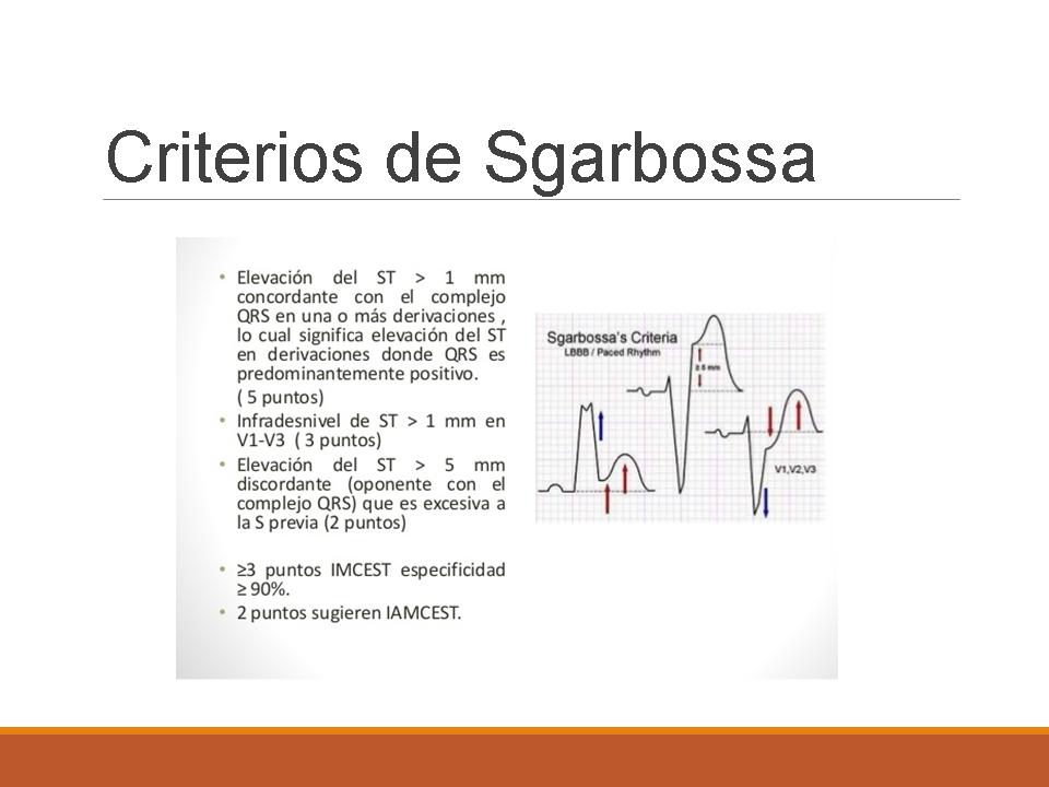 Criterios de Sgarbossa | cardiomap