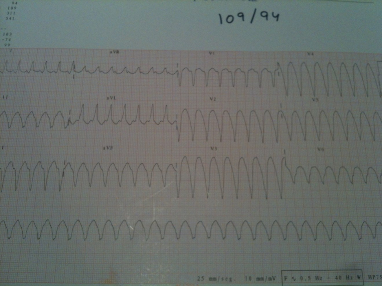 RITMO NODAL | cardiomap