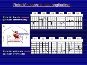 ¿Por qué, a veces, lo fácil se hace difícil? Levorrotación y ...