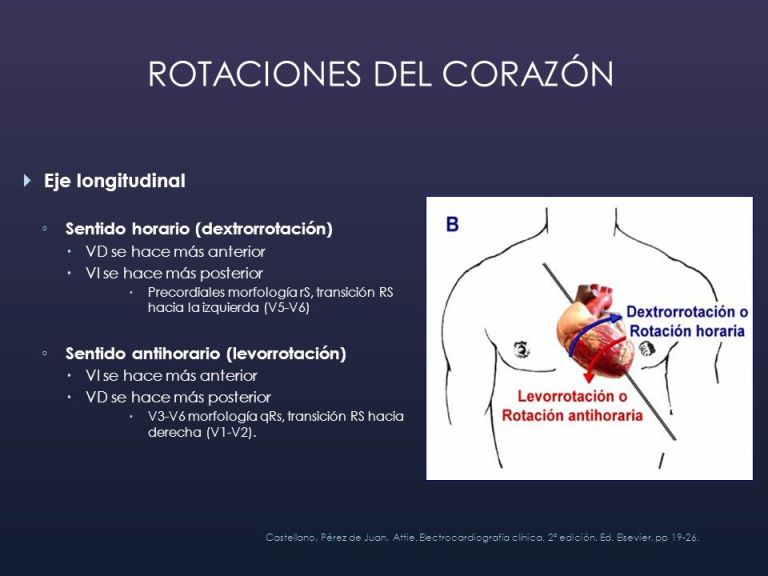 ¿Por qué, a veces, lo fácil se hace difícil? Levorrotación y ...